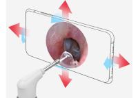 China Connected Ipad Ios Android 1280*720 Pixels Wifi Video Otoscope for sale