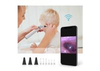China Waterproof Grade Ip67 Digital Video Otoscope Wifi Connection To Mobilephone for sale