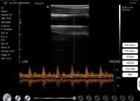 China Hand Held Ultrasound Wireless 10mhz Doppler Probe for sale