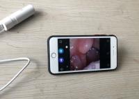 China 3mm Infinity Focusing Flexible Tube Usb Ear Endoscope Resolution 1280*720 for sale