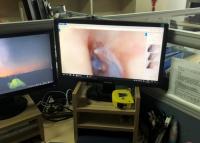 China Transmission Distance 6m Resolution 1280*720 Camera Intraoral Wifi for sale