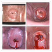 China Vaginal Camera Digital Electronic Colposcope to Find Disease of Cervix Eealier for sale
