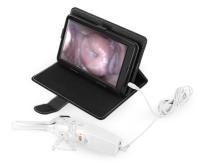 China Self - Inspection Handheld Digital Electronic Colposcope Transvaginal Detector With Dimension of 126×40×34mm for sale