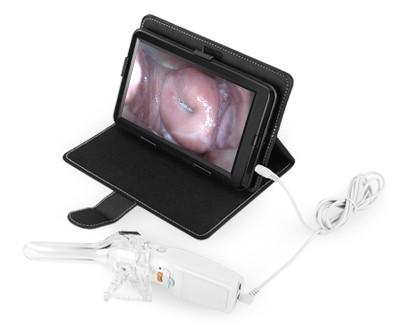 China Self - Inspection Handheld Digital Electronic Colposcope Transvaginal Detector With Dimension of 126×40×34mm for sale