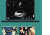 China 2.5mhz Dual Heads Convex Handheld Ultrasound Scanner for sale