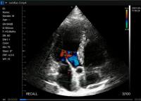 China 128 Element Cardiac Ultrasound Scanner Color Doppler Android 3.6MHz for sale
