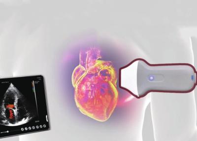 China IOS Windows System Android Ultrasound Scanner USB Wifi Color Doppler 10MHz Linear for sale