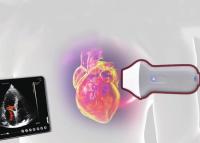 China Windows Android Personal Ultrasound Scanner For Home Use 3.6MHz for sale