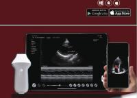 China Doppler B Mode Ultrasound Scanner 2.2MHz Wireless Ultrasound Machine for sale