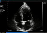 China PW PDI At Home Ultrasound Scanner 3.6Mhz Phased Array Probe for sale