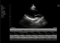 China 3.6MHz Color Doppler Android Ultrasound Scanner 128 Element for sale
