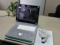 China 3D Digital Laptop Portable Ultrasound Scanner With All Kinds of Probe for sale