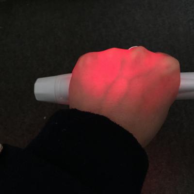 China Mini Vein Light Infrared Vein Finder Light Brightness Adjustment for sale