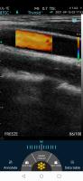 China USB Wifi Color Doppler Ultrasound Handheld Ultrasound Probe Android IOS Windows System Available for sale