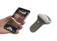 China Full Digital Handheld Ultrasound Scanner Portable Wireless Medical Wifi 125 Gram for sale