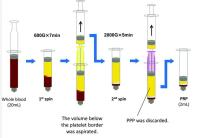 China Kit PRP for PRP centrifuges platelet rich plasma  disposable syringe Brushless motor for sale