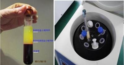 China PRP/ PRF CENTRIFUGE Blood Separation Machine  Digital Lab Equipment Brushless Motor for sale