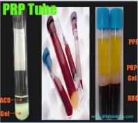 China Centrifuges with maximum speed of 4000 RPM and angle rotor capacity suitable for blood separation and PRP extraction processes for sale