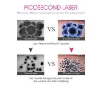 China Tattoo Laser Removal Picosecond Laser Tattoo Removal Machine Pico Laser Machine for sale