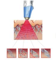 China 4 in 1 Infrared Laser Vacuum RF Roller Body Slimming Machine for sale
