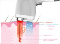 China Professional Laser Hair Removal Machine Hair Remov Diod Laser Machine for sale