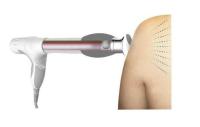 China Factory Sale Eswt Shockwave Therapy Machine Shock Wave Therapy for ED Laser for sale