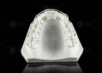 China Hard Occlusal Splint Dental For Jaw  Relief Protection Oral Splint for sale