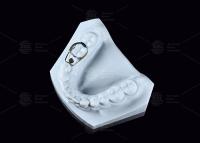 China SS Pediatric Space Maintainer Comfortable Hygienic Dental Space Maintainer For Adults for sale