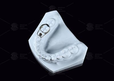 China SS Pediatric Space Maintainer Comfortable Hygienic Dental Space Maintainer For Adults for sale