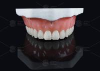 China China Dental Lab Titanium Locator Attachment with full acrylic over denture for sale