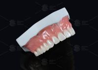 China China Dental Lab Titanium Locator Attachment with full acrylic over denture for sale