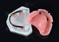China China Dental Lab Titanium Locator Attachment with full acrylic over denture for sale