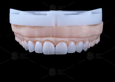 China China Dental Lab Over 13 Years In Dental Lab Industry Providing Emax Veneer 16 Shades To Meet Diverse Dental Restoration Needs for sale
