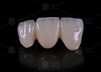 China China Dental Lab Accurate Precision Of Margins Layered Zirconia Hypoallergenic Biocompatible Dental Material For Durable And Restorations for sale