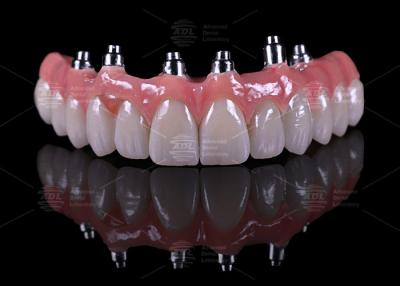 China China Dental Lab Titanium Screw Retained Malong Design A1 Shade Full Arch Hybrid Bridge for sale