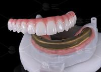China Innovative Dental Lab Outsourcing Services Combining Advanced Techniques And Control For Dental Healthcare Providers for sale