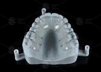 China China Dental Lab Customizable Hawley Retainer Comfortably Removable Retains Teeth Position Effectively for sale