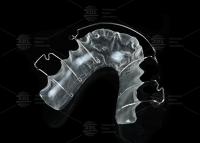 China China Dental Lab Customizable Hawley Retainer Comfortably Removable Retains Teeth Position Effectively for sale