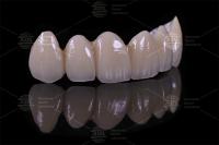 China Top 5 China dental lab providers Porcelain Fused To Zirconia ensuring turnaround time in 72 hours service for dental offices and labs for sale