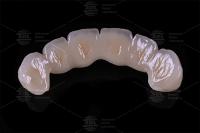 China Top 5 China dental lab providers Porcelain Fused To Zirconia ensuring turnaround time in 72 hours service for dental offices and labs for sale