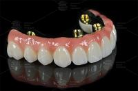 China Professional Dental Lab Outsourcing Services Delivering Accurate Dental Prosthetics and Custom Solutions for Dental Industry Needs for sale