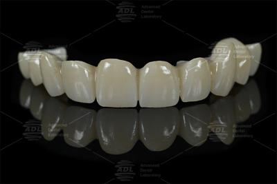 China China Dental Lab Full Zirconia dental restorations dental lab specializing in AIDITE ZIRCONIA BLOCK materials for durable dental solutions for sale