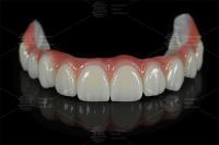 China China Dental Lab Titanium And Zirconia All On X In 16 Shades Including A1 A2 A3 From Dental Lab For Natural Dental Aesthetics for sale
