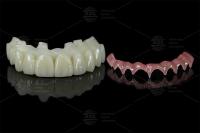 China Screw Retained 3D Printed Implant Support Bar for Try In Direct to Fixture of ALL ON X From Chinese Dental Lab for sale