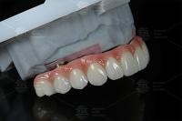China China Dental Lab Compatible With Most Dental Implant Systems All on 4 Offering In 72 Hours Turnaround Time And Array Technical Parameters for sale