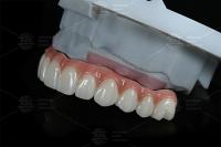 China China Dental Lab Compatible With Most Dental Implant Systems All on 4 Offering In 72 Hours Turnaround Time And Array Technical Parameters for sale