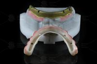 China China Dental Lab Compatible With Most Dental Implant Systems All on 4 Offering In 72 Hours Turnaround Time And Array Technical Parameters for sale