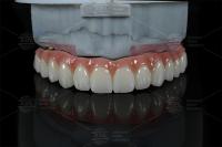 China China Dental Lab Compatible With Most Dental Implant Systems All on 4 Offering In 72 Hours Turnaround Time And Array Technical Parameters for sale
