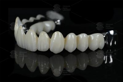 China China Dental Lab Outsource Dental Lab Ti Reinforcement Bar With Full Zirconia Providing Competitive Pricing With Volume Discounts Tailored To Dental Professionals Requiring And Manufacturing for sale