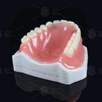 China China Dental Lab Titanium Locator Attachment with full acrylic over denture for sale